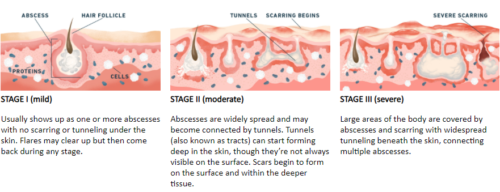 Dermatological Conditions - Bellaire Dermatology